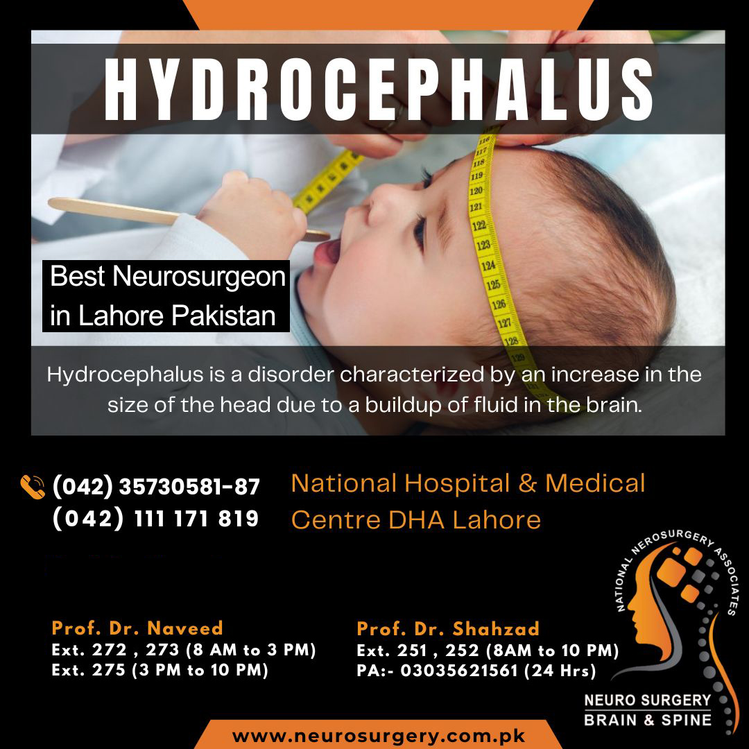 Best Hydroscephalus Surgeon in Lahore Pakistan - Neurosurgery