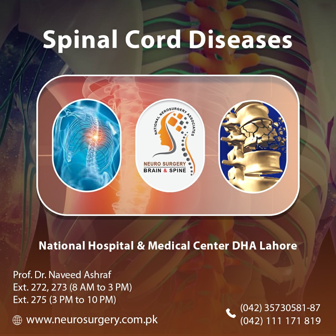 Best Spinal Cord Diseases Surgeon in Lahore Pakistan - Neurosurgery